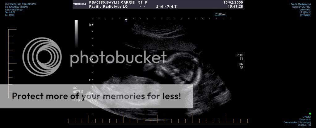 Ultrasound Animated Gifs | Photobucket
